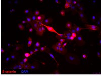 SCC-61 Human Squamous Cell Carcinoma Cell Line | SCC280
